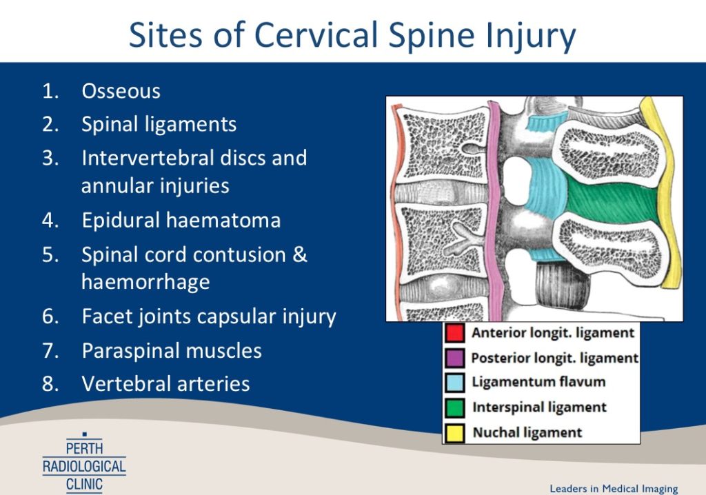 » sites-of-cervical-spine-injury